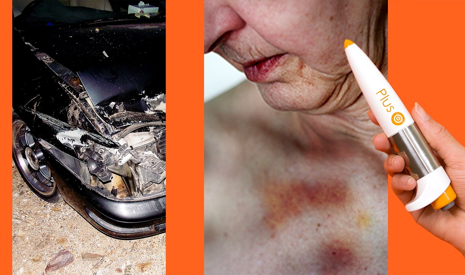 This Revolutionary New Pen-Sized Medical Device Relieves My Pain In ...