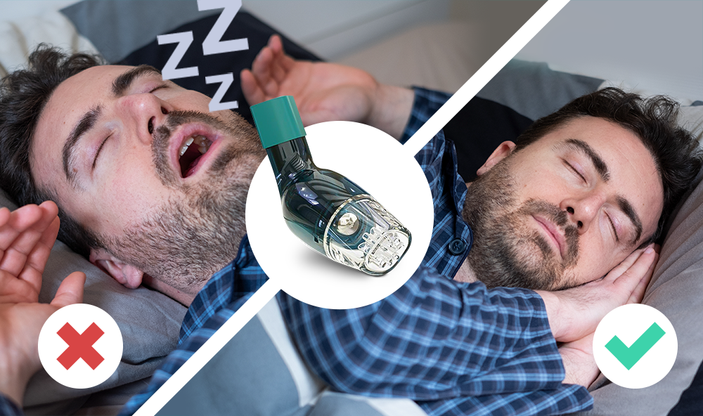 Genius Anti-Snoring Device Helps Snorers Silence Their “Buzzing ...